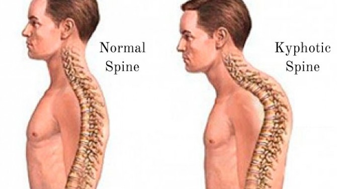 Relax the Back: How to Become a Stronger Paddler | The Inertia