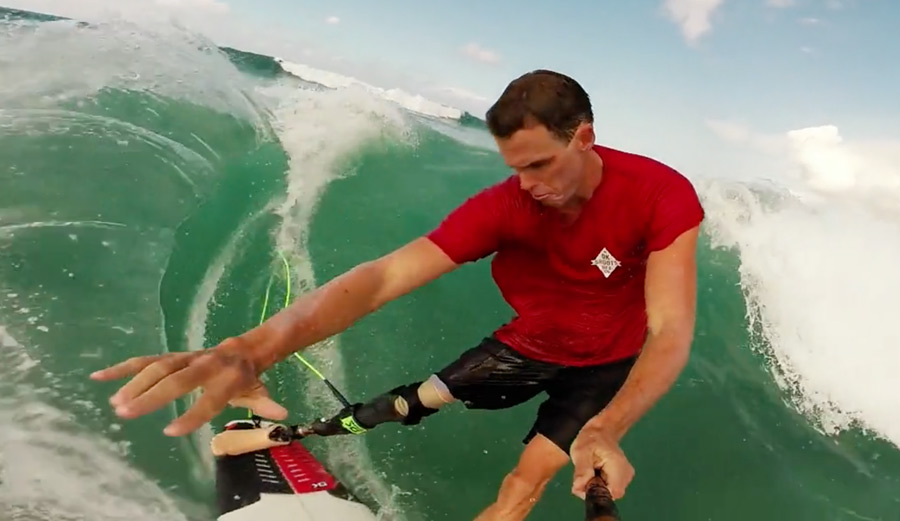 The Raddest Snap You've Ever Seen with a Prosthetic Leg | The Inertia