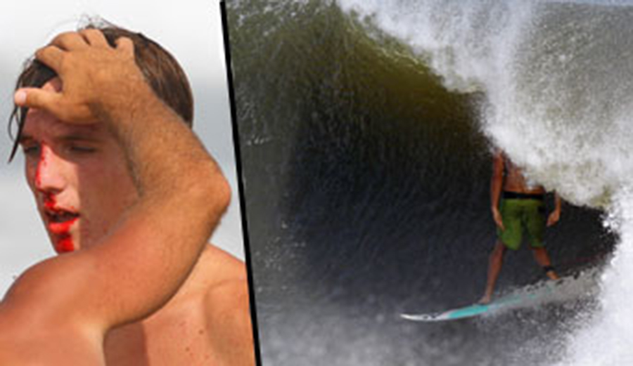 Here's a New Must for a Surfer's First Aid Kit | The Inertia