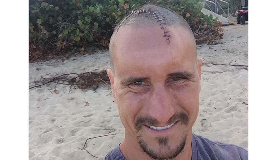 Aaron Gold's Serious Head Wound on North Shore | The Inertia