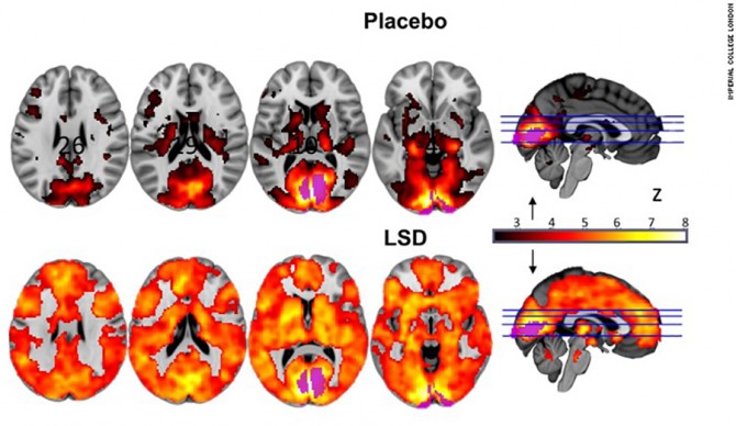 This Is What Your Brain Actually Looks Like On LSD | The Inertia