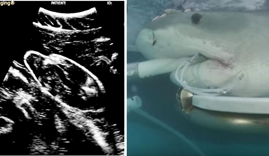 Ultrasound on a Pregnant Shark | The Inertia