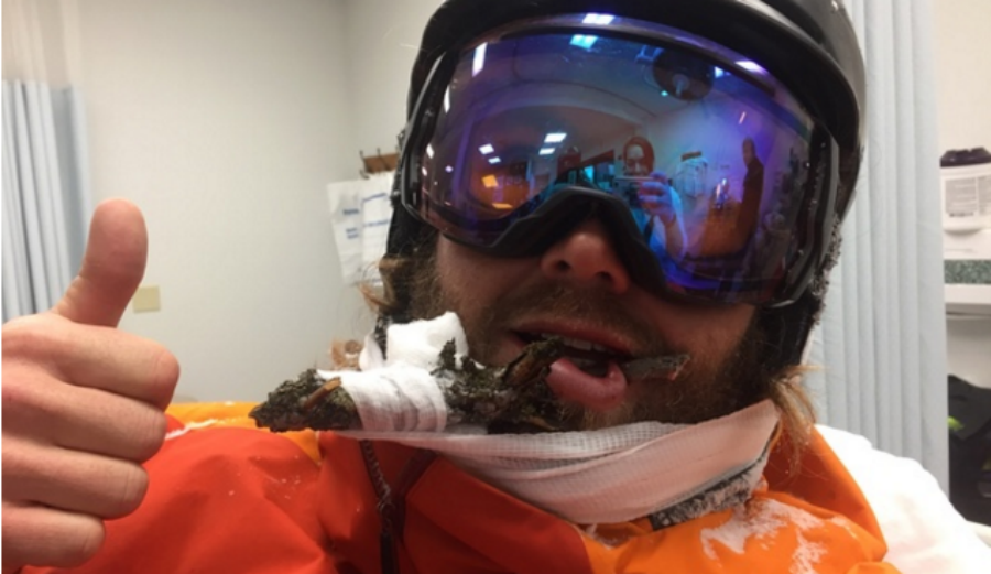 Good-Humored Snowboarder Gets Impaled By Branch, Tells Friend "I Got a ...