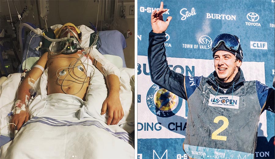 Here's a List of Mark McMorris's Injuries After His Recent Accident; It ...