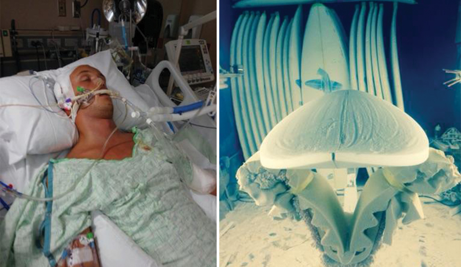 After Smashing His Skull This Skater Has a New Lease on Life | The Inertia