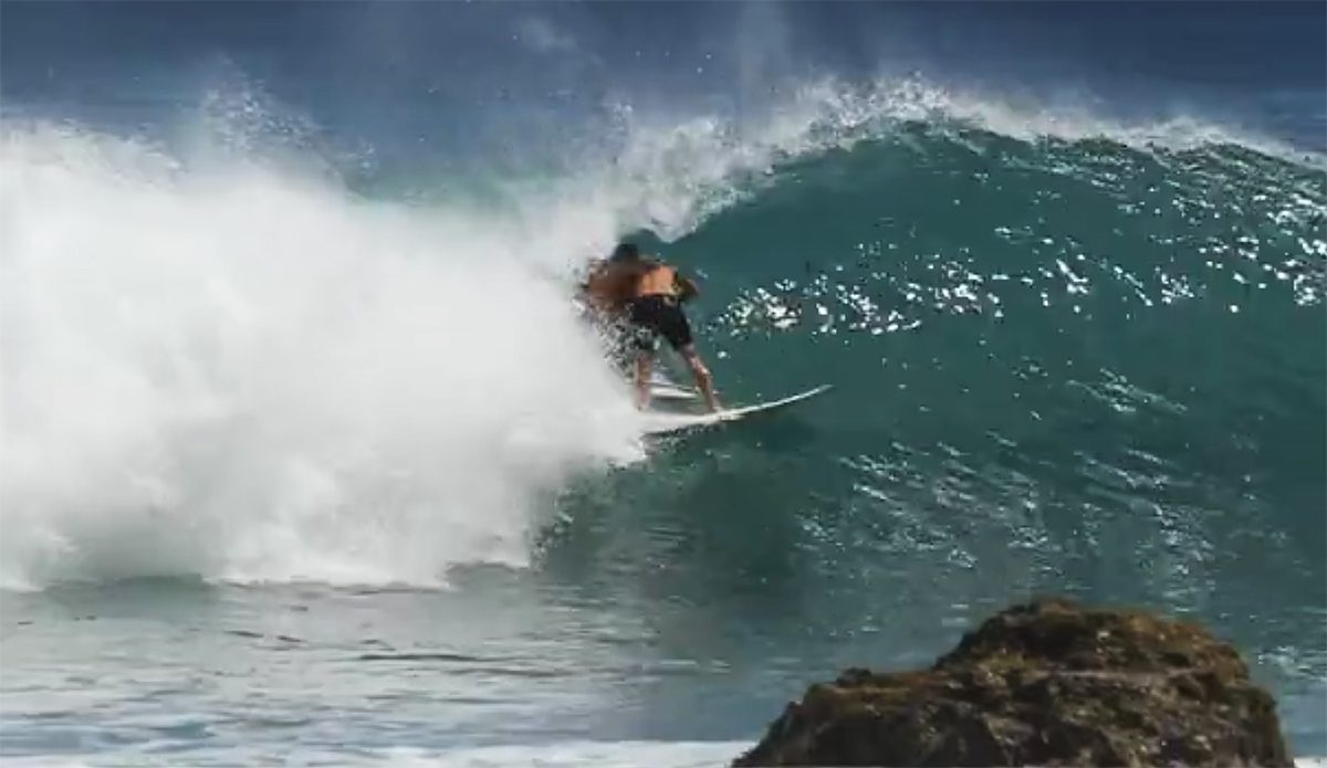 How Often You Complain about Getting Burned vs. How Much You Burn ...