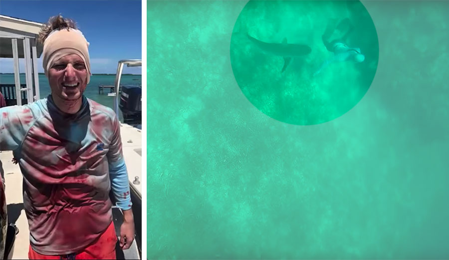 Terrifying GoPro Video Shows Moment Man Gets Bitten on Head by Shark ...