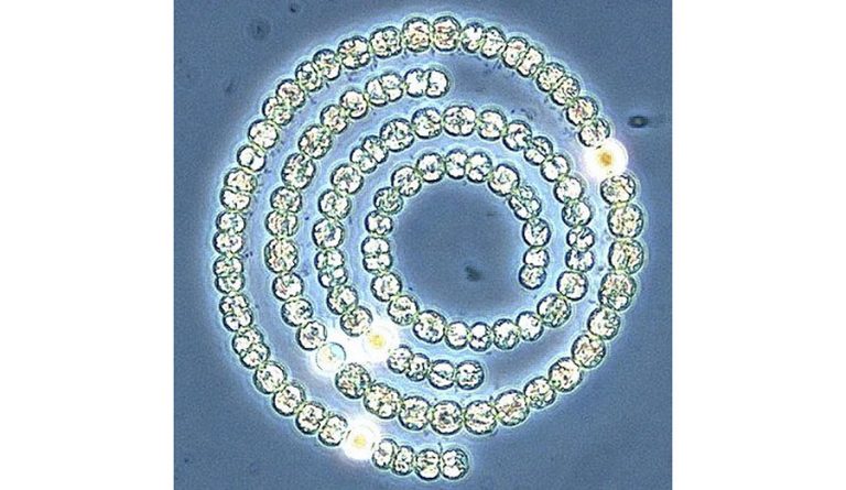 Here’s What Causes Algal Blooms, and How We Can Stop Them | The Inertia
