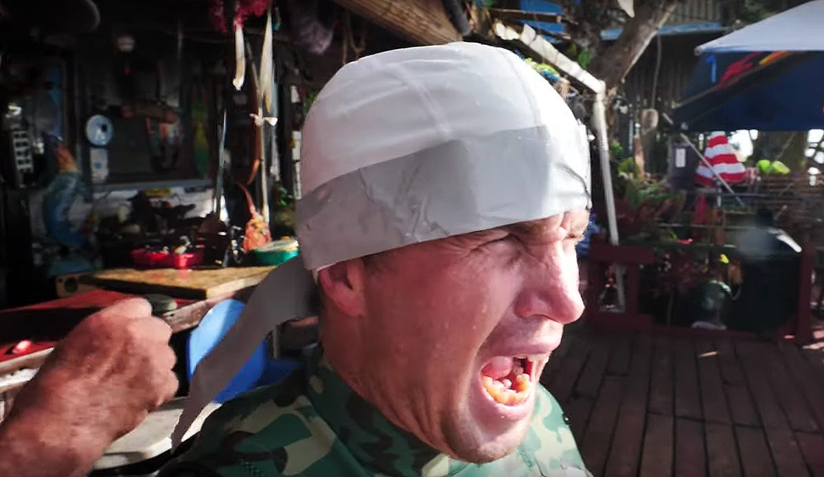 Jamie O’Brien Duct-Taped His Head and Surfed Pipe Three Days After ...