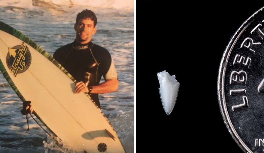 Florida Man Pulls Shark Tooth From His Foot Nearly 25 Years After ...