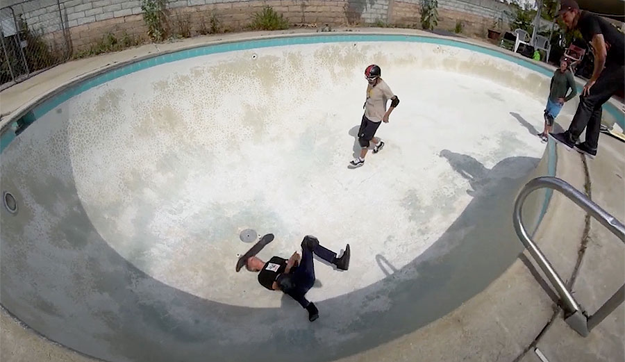 Tony Hawk Severely Mangled His Fingers Skating a Backyard Pool