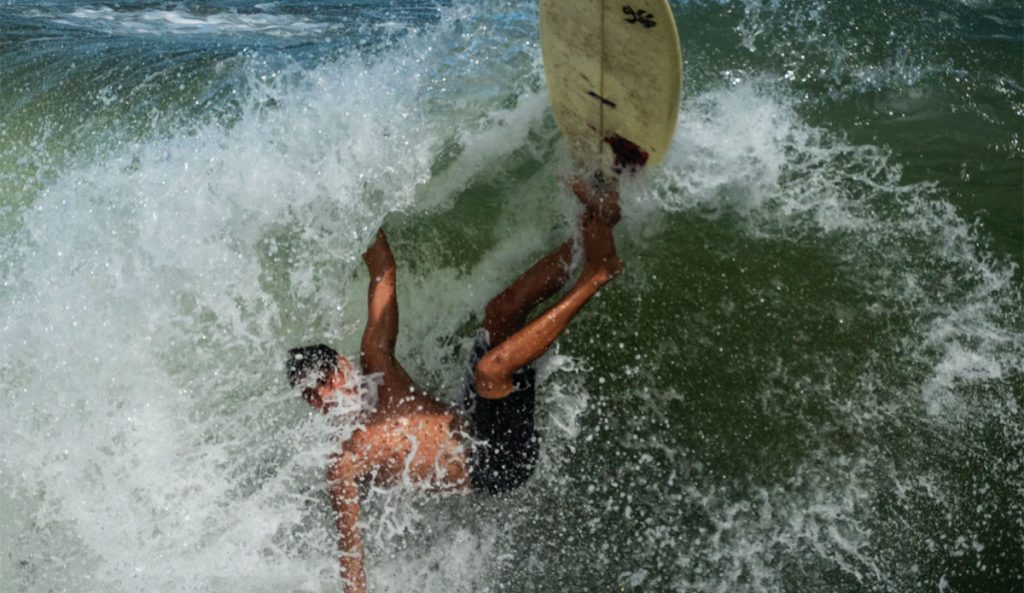 Strengthen Or Snap: Surfing’s Most Common Injuries and How to Avoid Them