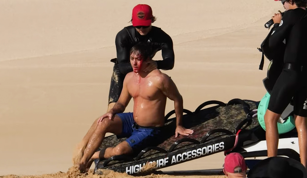 Koa Rothman Walks Through His Brutal Pipeline Injury
